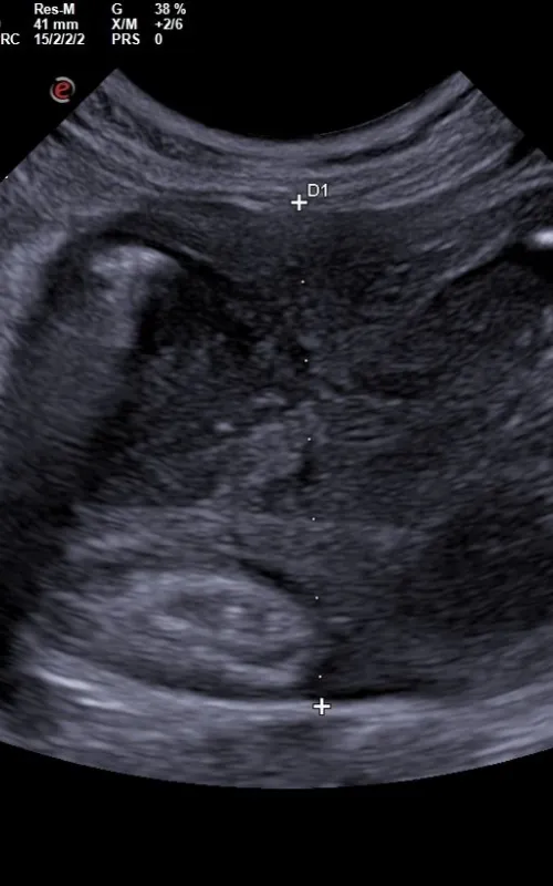 Kitty | Patient Stories | Cat Specialist Services